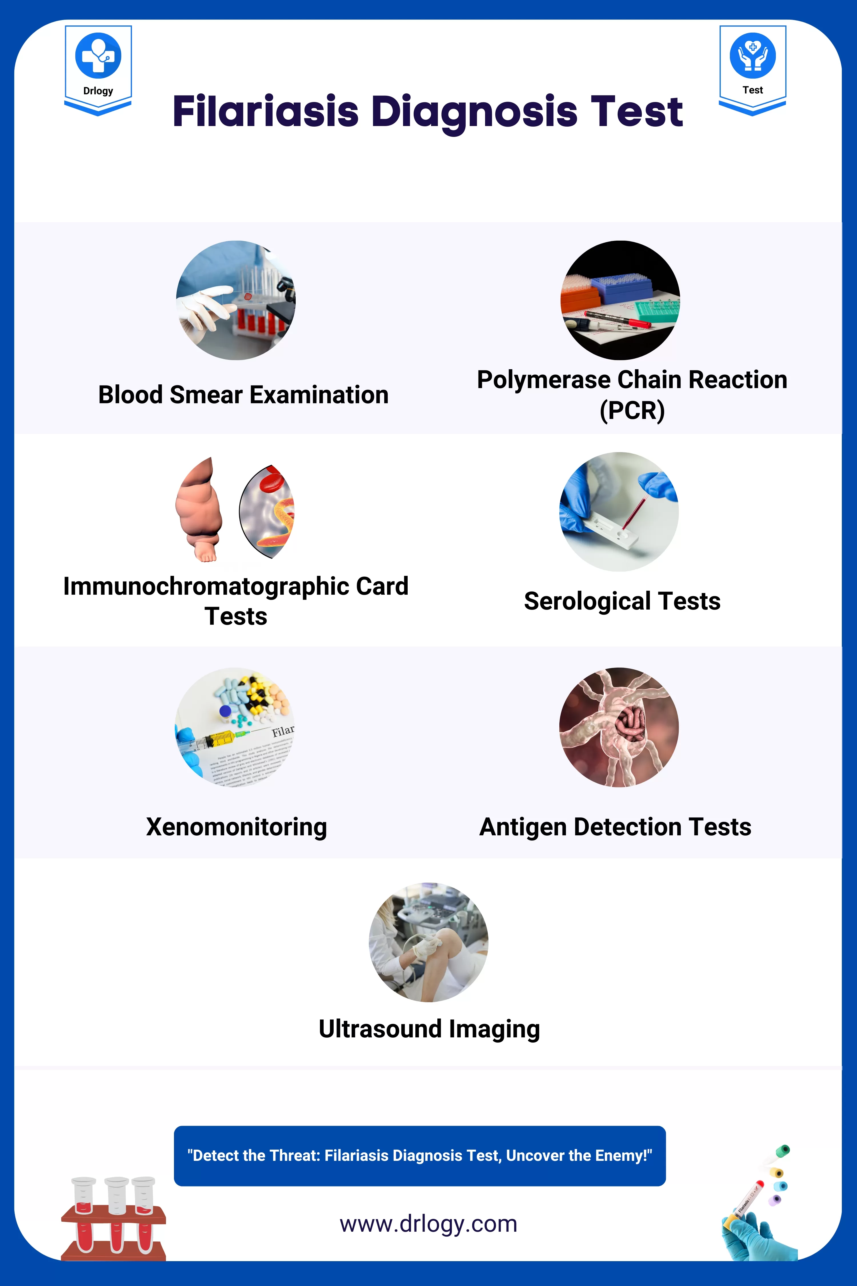 7 Filariasis Test for Fast and Accurate Diagnosis - Drlogy