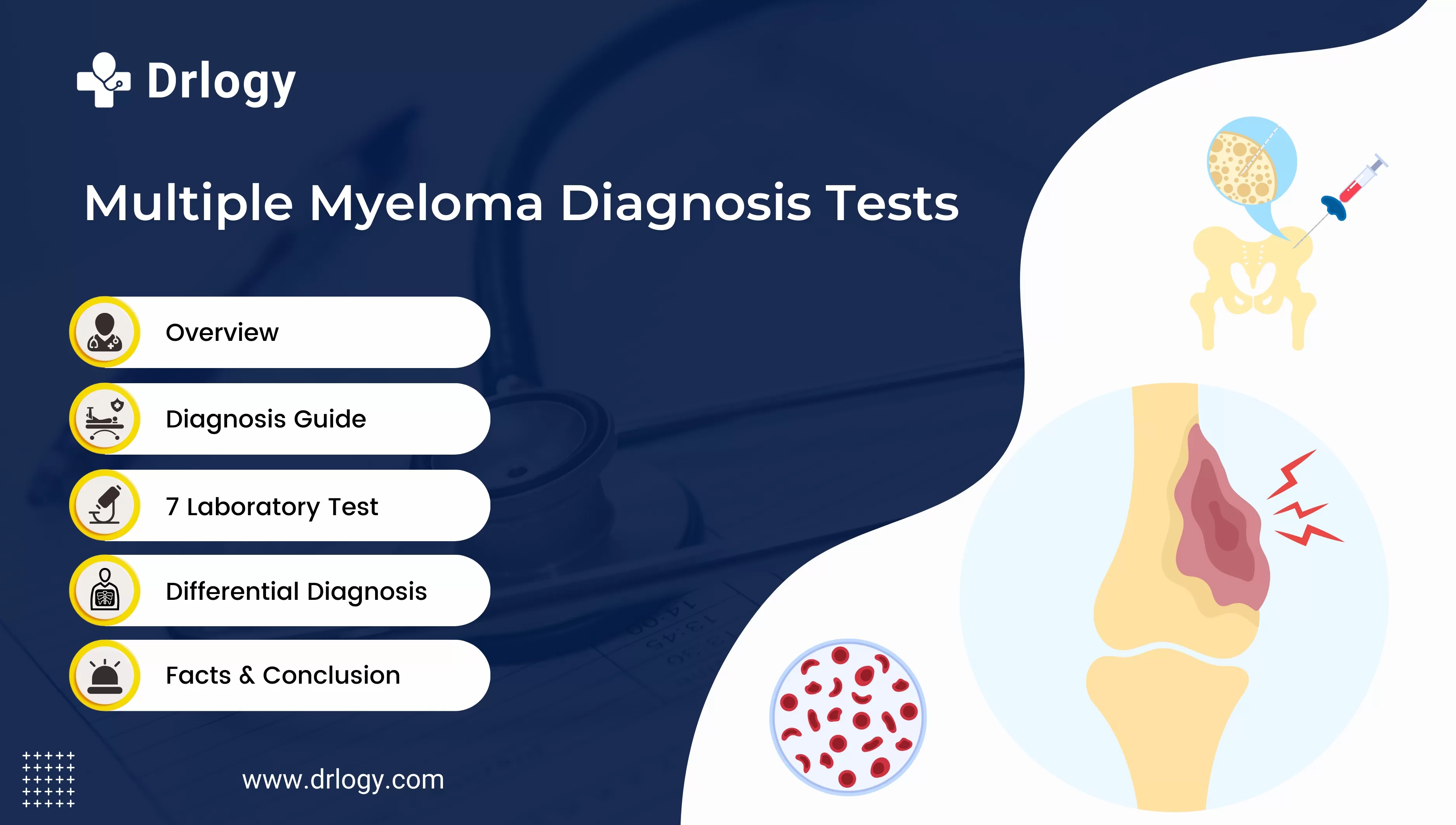 Early Detection Of Multiple Myeloma Ask The Nurse Expert