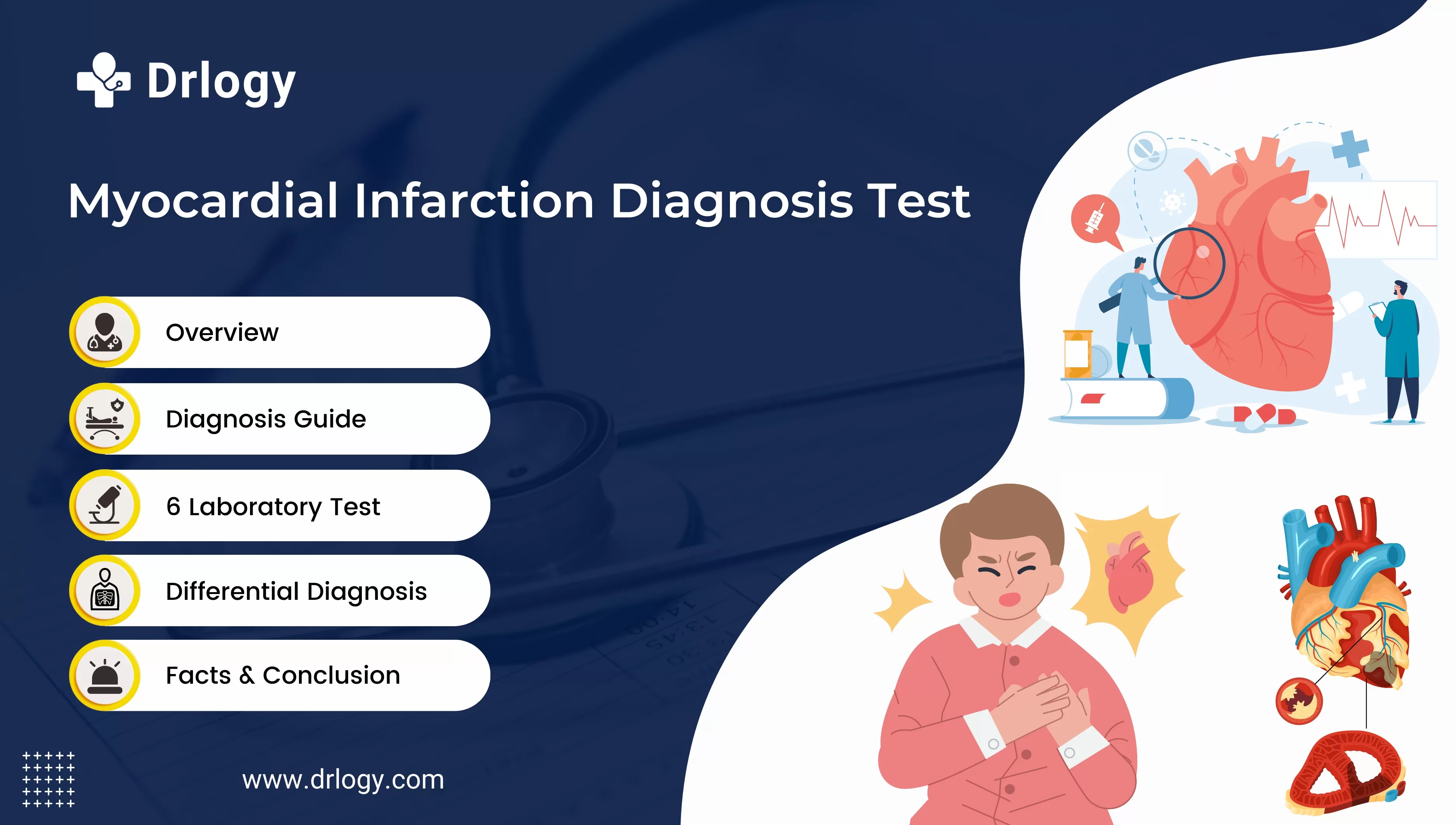 Myocardial Infarction Myocardial Infarction