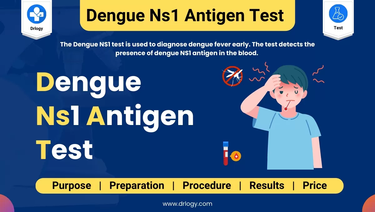 Dengue Ns1 Antigen Test: Price, Positive & Negative Results | Drlogy