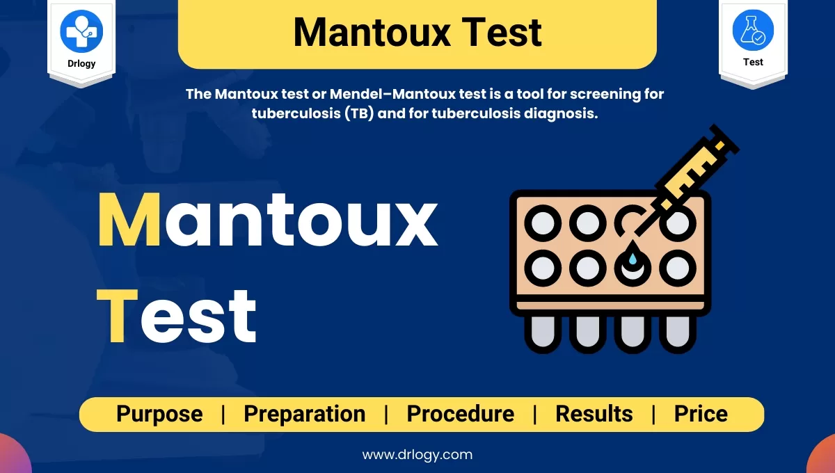 What Does Positive Mantoux Look Like 