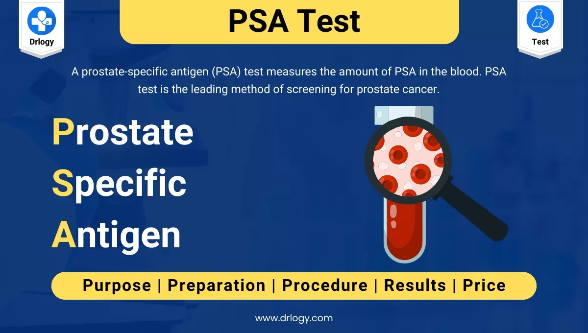 How Long Does It Take To Get PSA Test Results Drlogy